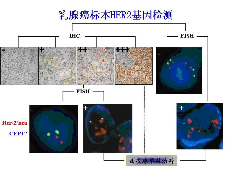 什么样的患者应该进行HER2的FISH 检测？-天津市肿瘤医院-北方网企业建站