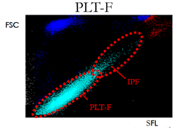 PLT-I、PLT-O和PLT-F“区分开”，血小板减少症“辨真伪”-天津市肿瘤医院-北方网企业建站